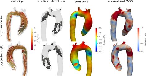 Vlachos Research Group Wall Shear Stress Estimation For D Flow MRI Using Navier Stokes