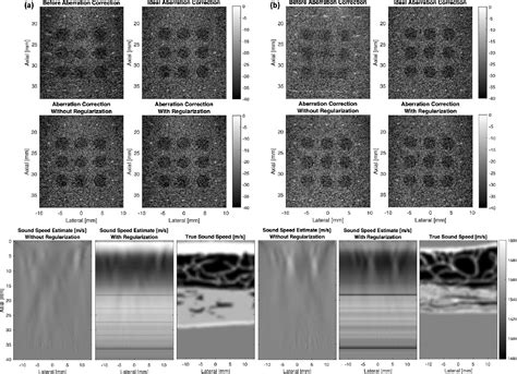 Figure 1 From Iterative Sound Speed Tomography For Distributed Aberration Correction Semantic