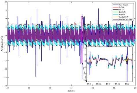 Remote Sensing Free Full Text Noise Attenuation For Csem Data Via