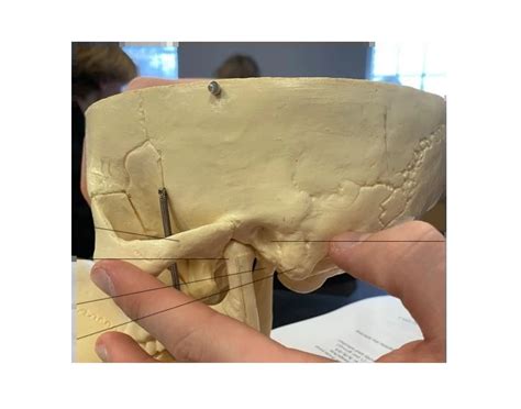 Temporal Bone Labeling — Printable Worksheet