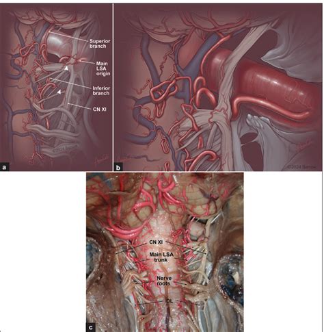 Surgical Neurology International