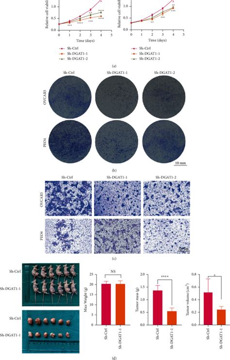 Dgat1 Expression Promotes Ovarian Cancer Progression And Is Associated
