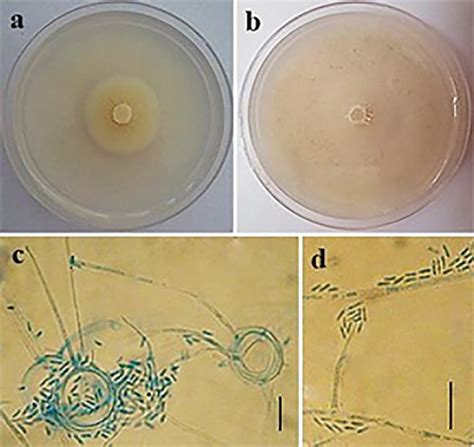 Sarocladium Strictum A Colony On Pda B Colony On Oa After Seven