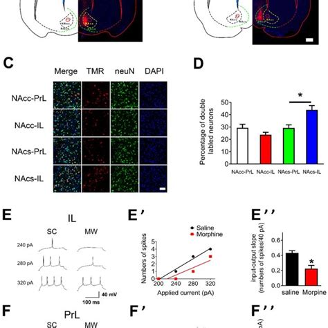 Neuronal Excitability Of Layer 5 Pyramidal Neurons In Il Is Decreased Download Scientific