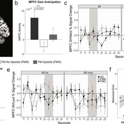 Medial Prefrontal Cortex Activation During Gain Anticipation And Download Scientific Diagram