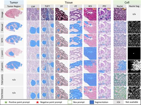 Segment Anything Model Sam For Digital Pathology Assess Zero Shot