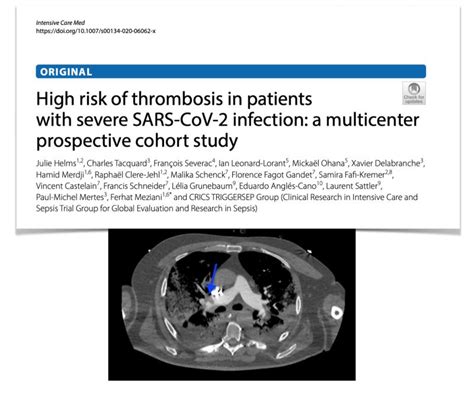 Jon Neyman Posted On Linkedin