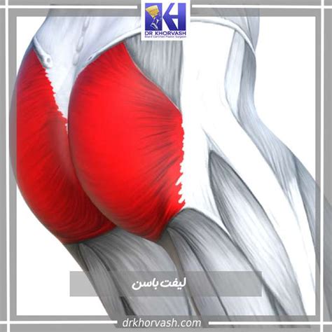 عمل لیفت باسن در تهران ماندگاری جراحی لیفت باسن برزیلی دکتر بهزاد خوروش