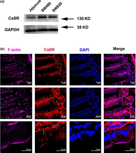 The Expression Of Casr In Mouse Jejunum Mucosal Tissues A After