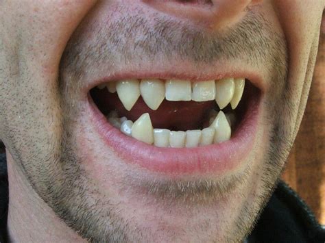 Male Vampire Teeth Pictures