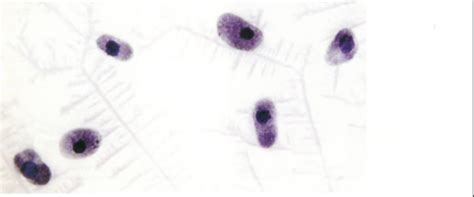 Chapter33 Invertebrates Part Ii Ecdysozoans Flashcards Quizlet