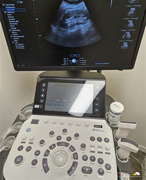 힘들었던 초음파 소노그래퍼 입문기 네이버 블로그