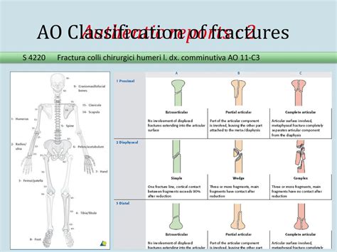 Fractures Ppt Download Fractures Ppt Download
