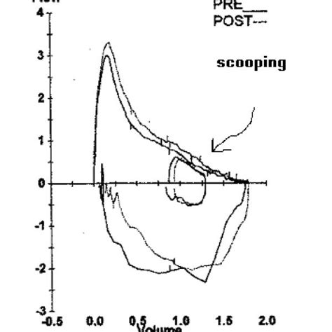 Pulmonary Function Test The Pulmonary Function Test Was Performed Download Scientific Diagram