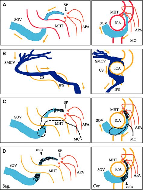 Schematic Drawings Of The Anatomical And Hemodynamic Features Of The Download Scientific