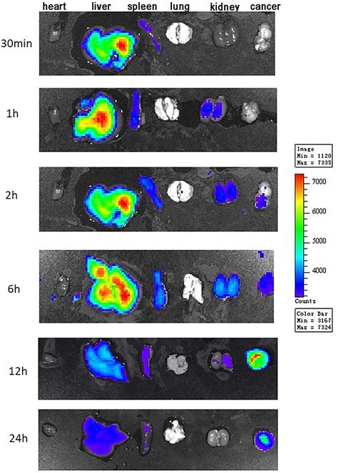Tumor Microenvironment Multiple Responsive Nanoparticles For Targeted Ijn
