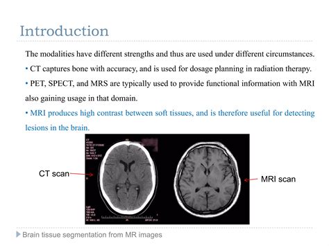 Brain Tissue Segmentation From Mr Images Ppt