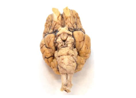 Sheep Brain Labeling Diagram Quizlet