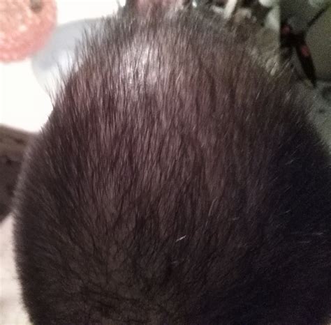 Diffuse Thinner Can I Still Save It Tressless