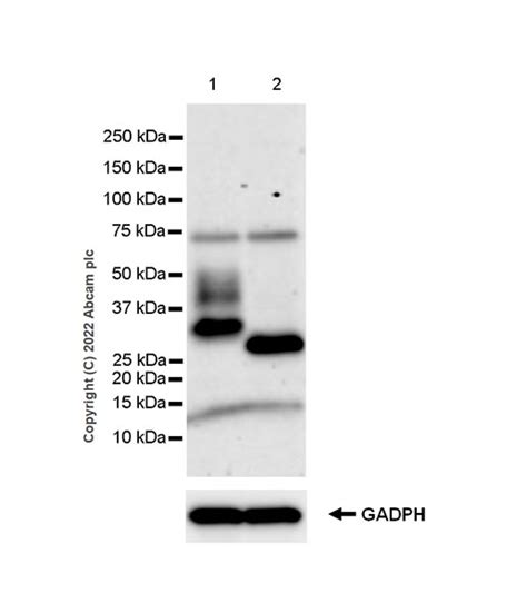 Anti Trem2 Antibody Epr26210 1 Ab305103 Abcam