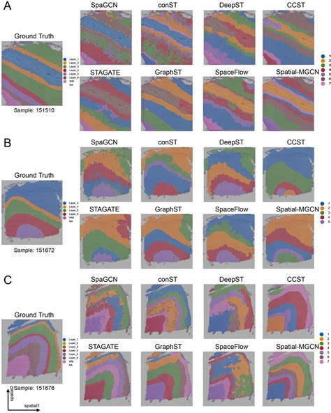 A Comprehensive Overview Of Graph Neural Network Based Approaches To
