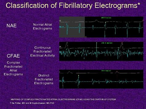 New Targets Of Af Ablation Cfae And