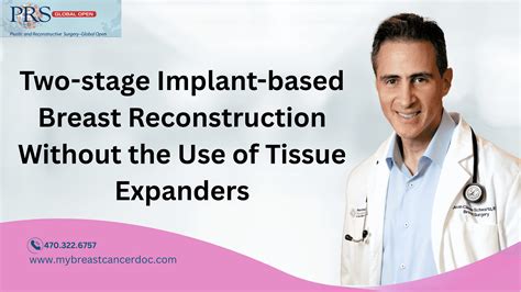 Two Stage Implant Based Breast Reconstruction Without The Use Of Tissue Expanders My Breast