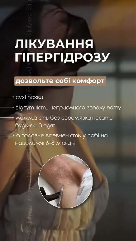 Лечение гипергидроза ботокс сторис косметолога