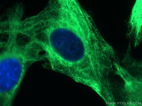 Desmin Antibody 16520 1 Ap Proteintech
