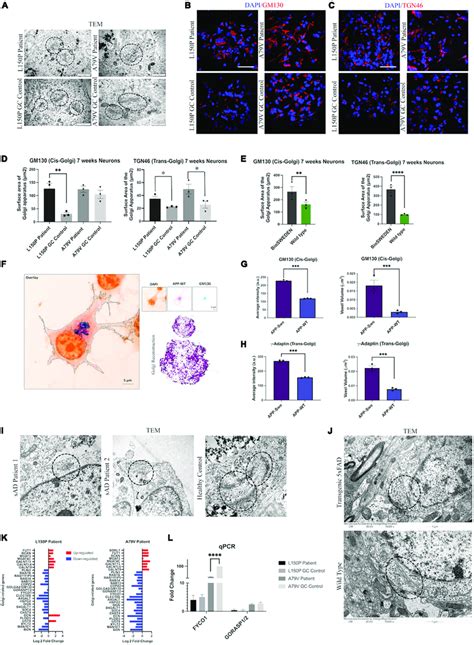 Golgi Fragmentation Is A Universal Phenotype In Ad A Tem Evaluation Download Scientific