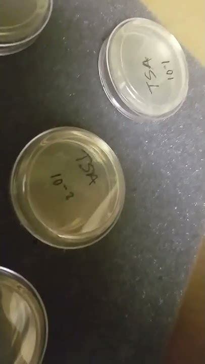 Bacterial Enumeration Dilutions And Plate Count Part 3 Youtube