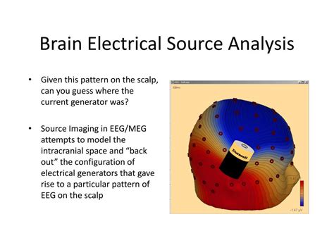PPT Electroencephalography PowerPoint Presentation Free Download ID