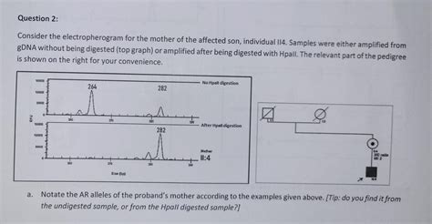 Solved Consider The Electropherogram For The Mother Of The
