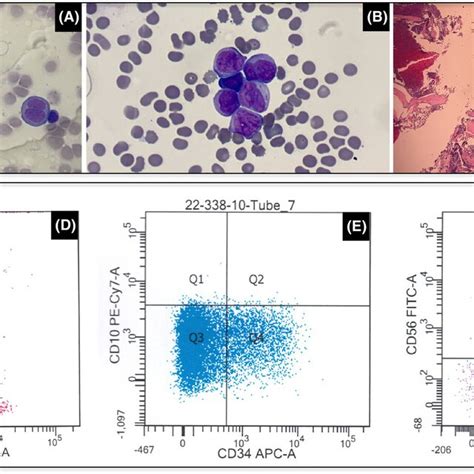 Molecular Genetic Analyses By Pcr Showing Pml‐rarα And Flt3‐itd Download Scientific Diagram