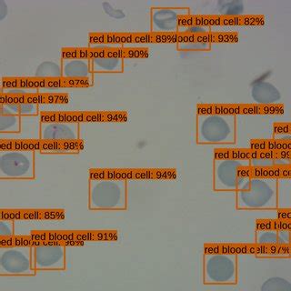 Sample Image Of Broad Institute Dataset With Object Detection Model Download Scientific Diagram