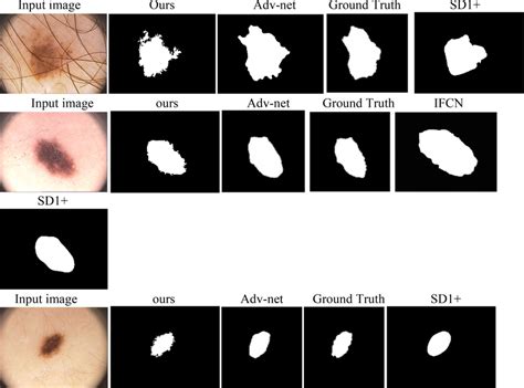 Visual Segmentation Result Comparison Of Segcaps With Other Methods Download Scientific Diagram