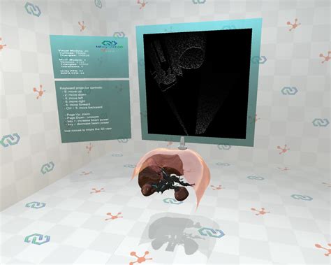 SofaUnity Asset Imaging Ultrasound InfinyTech D