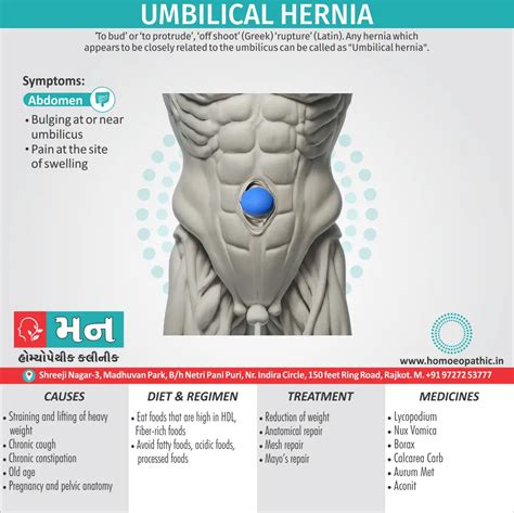 What Is Umbilical Hernia Pristyn Care