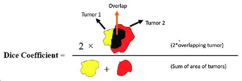 Illustration Of Dice Similarity Coefficient 2x Overlap Total Number Of Download Scientific