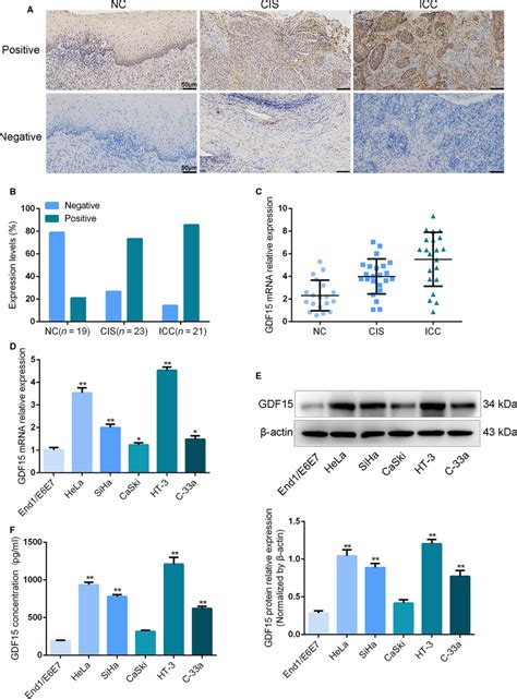 The Expression Of Gdf15 In Cervical Cancer Tissues And Cell Lines A