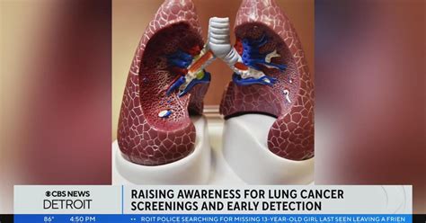 Raising Awareness For Lung Cancer Screenings Early Detection Cbs Detroit