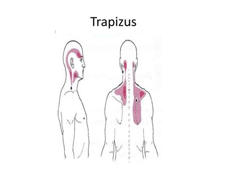 SOLUTION All Trigger Points Of Back And Upper Limb Studypool