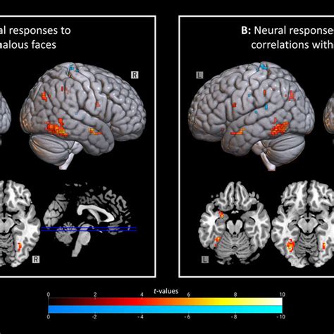 Selective Neural Responses To Anomalous Faces And Relations To Implicit Download Scientific