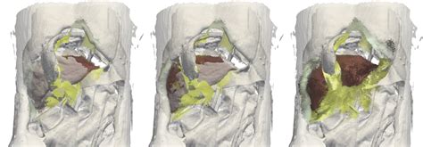Surface Reconstructions For Deformation 1 Sequence 2 From Left To