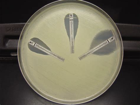 E Test Epsilometer Principle Procedure Results • Microbe Online