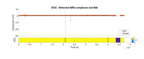 issue when having missing data · issue 10 · cliffordlab physionet