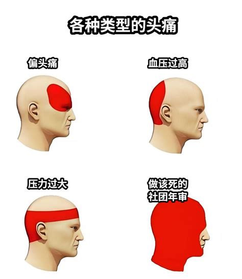 各种类型的头痛偏头痛血压过高压力过大游玩三角洲行动 网友制作的meme梗图