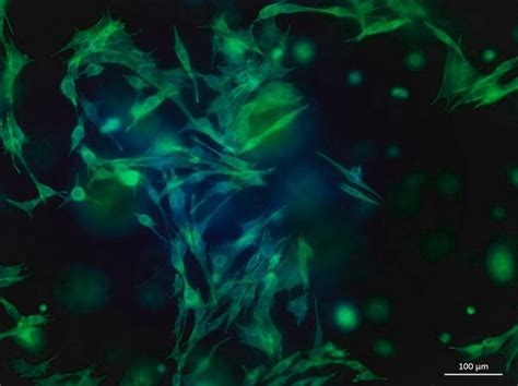 Tissuefab® Gelma Vis For 3d Bioprinting Applications Get Quote Rfq Price Or Buy