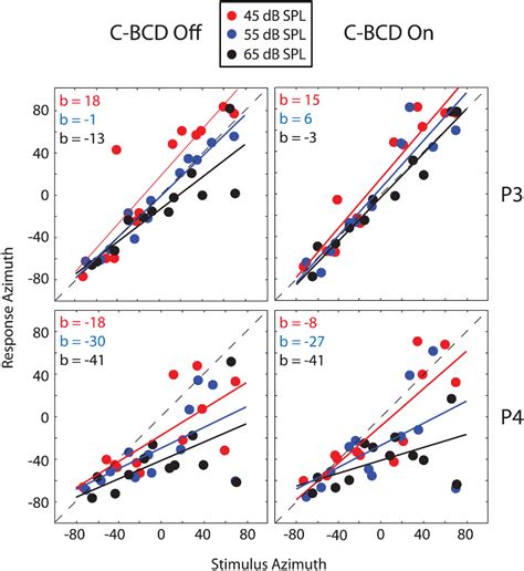 Figure 1 From Sound Localization Performance Of Patients With Single
