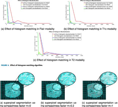Figure 1 From Automated Brain Tumor Segmentation Based On Multi Planar